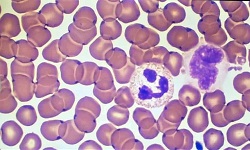 Calcofluor White (CFW) Staining - Principle, Procedure, Result ...
