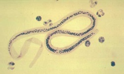 Wuchereria bancrofti - Introduction, Classification, History, Habitat ...