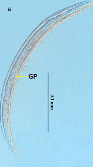 Strongyloides stercoralis - Laboratory Diagnosis